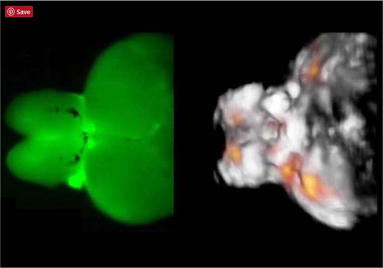 Watching the brain in action - MankindsBest.com